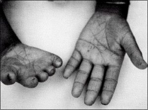 Dr. Ian Stevenson's Reincarnation Research - Near-Death Experiences and ...